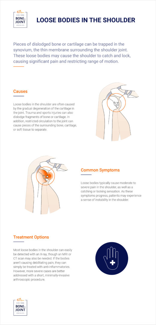 Loose Bodies in the Shoulder Specialist in NYC | NY Bone & Joint