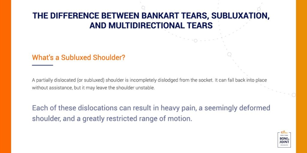 What's the Difference Between Bankart Tears, Subluxation, and Multi ...