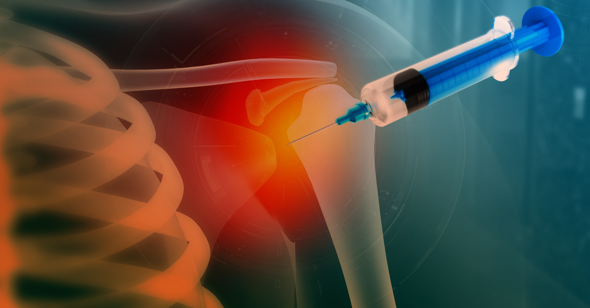 Do Cortisone Shots Work for Joint Pain? - New York Bone & Joint Specialists